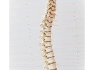 Warum is der Rücken krumm?